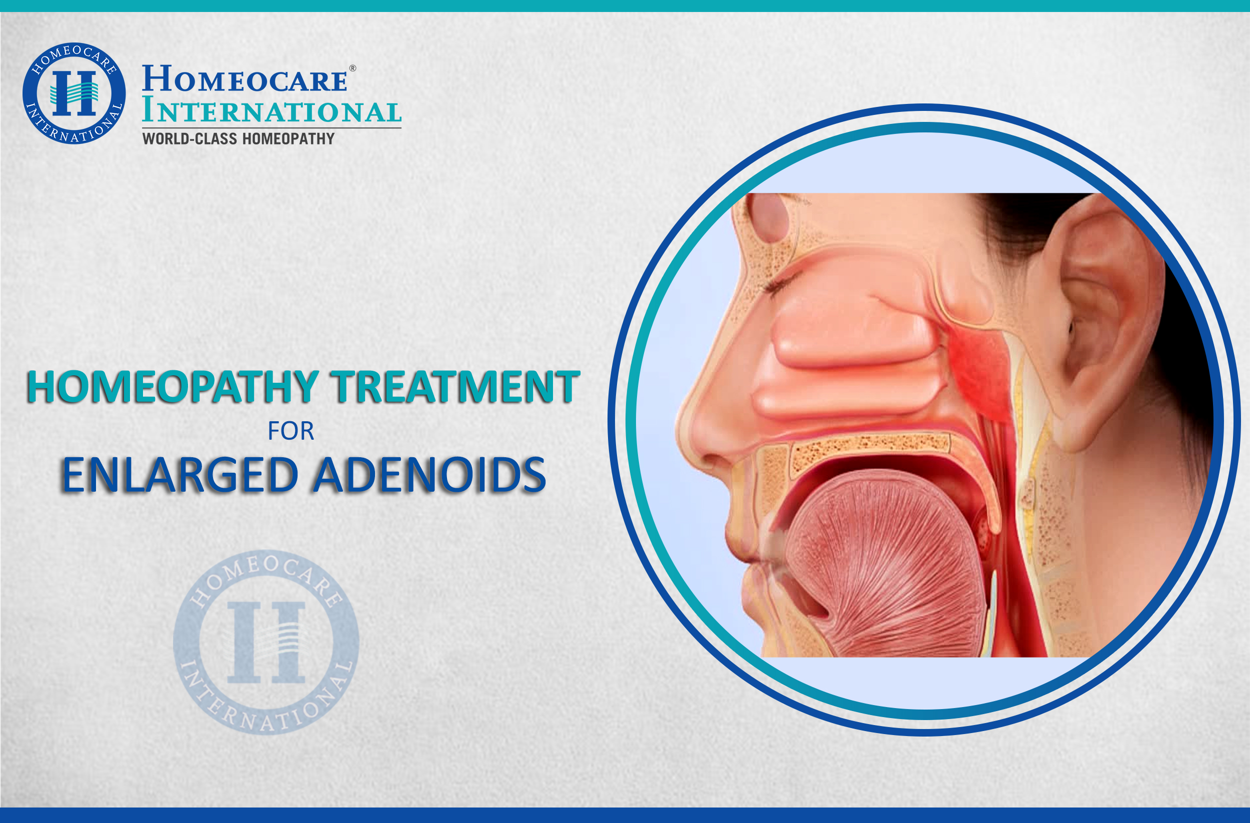 Role Of Constitutional Homeopathy For Enlarged Adenoids