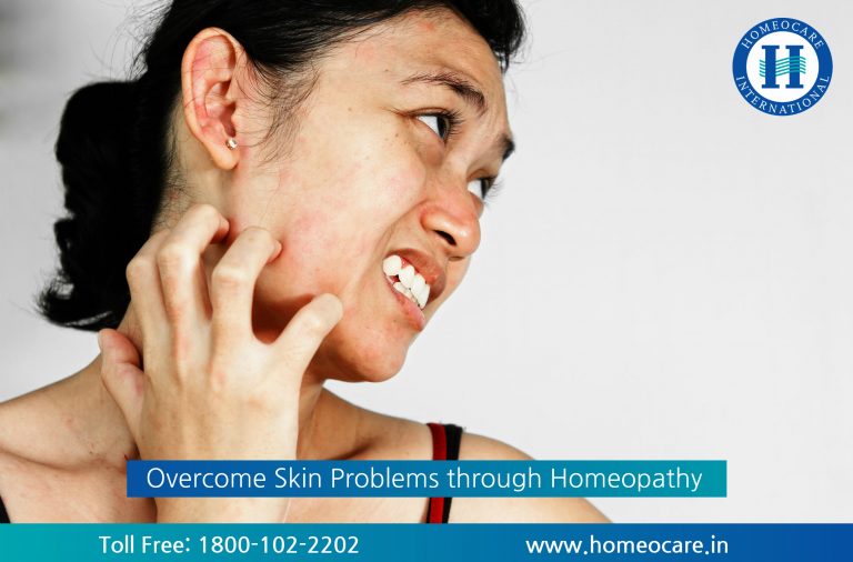 Tips to Protect Skin in Monsoon